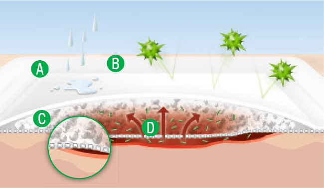 L&R Global: Vliwasorb adhesive