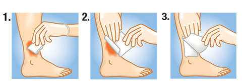L&R Global: Suprasorb X