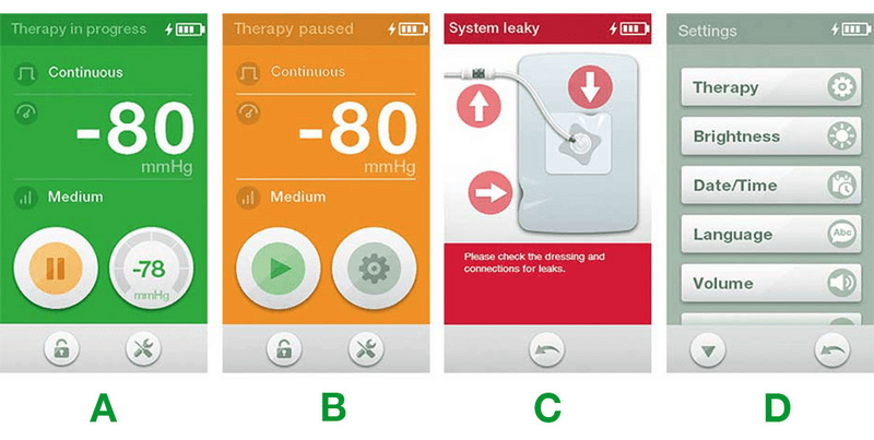 L&R AE: Suprasorb CNP P3 Therapy Unit