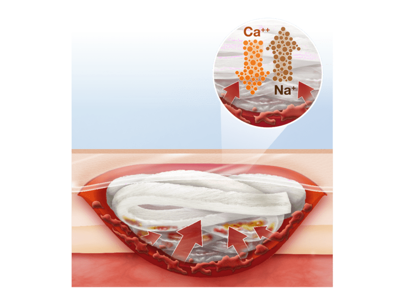 L&R Deutschland: Suprasorb A Pro