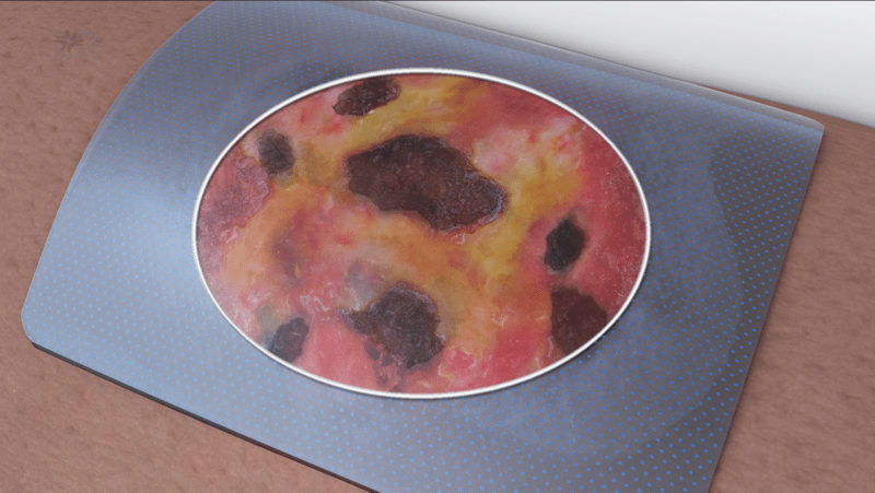 L&R Australia/New Zealand: Suprasorb G